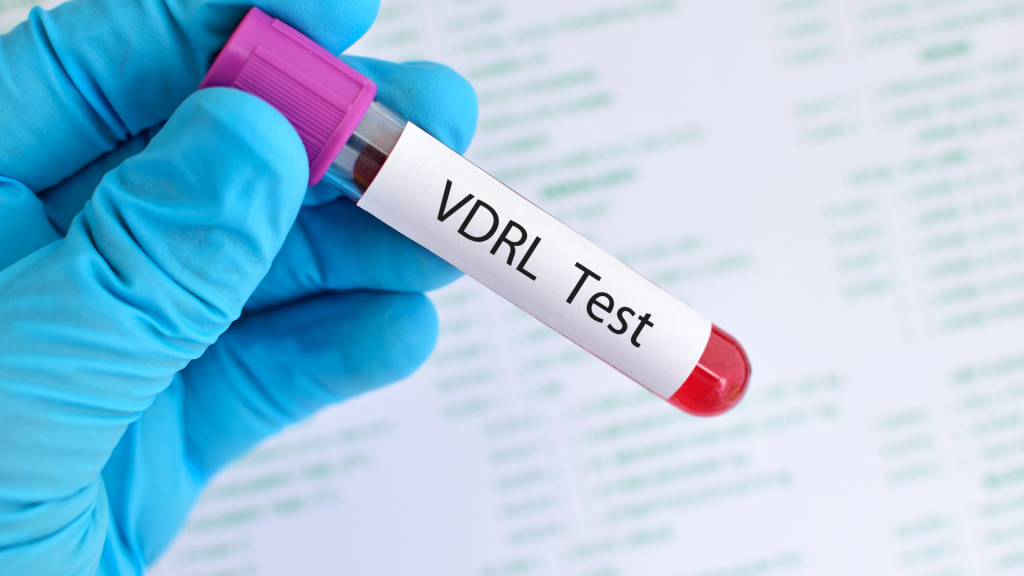 VDRL Testi fiyatları 2026