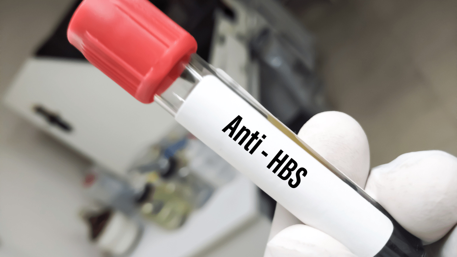 Anti HBc Testi Nedir? | IgM / IgG Farkı, Test Sonuçları ve Pozitiflik ...