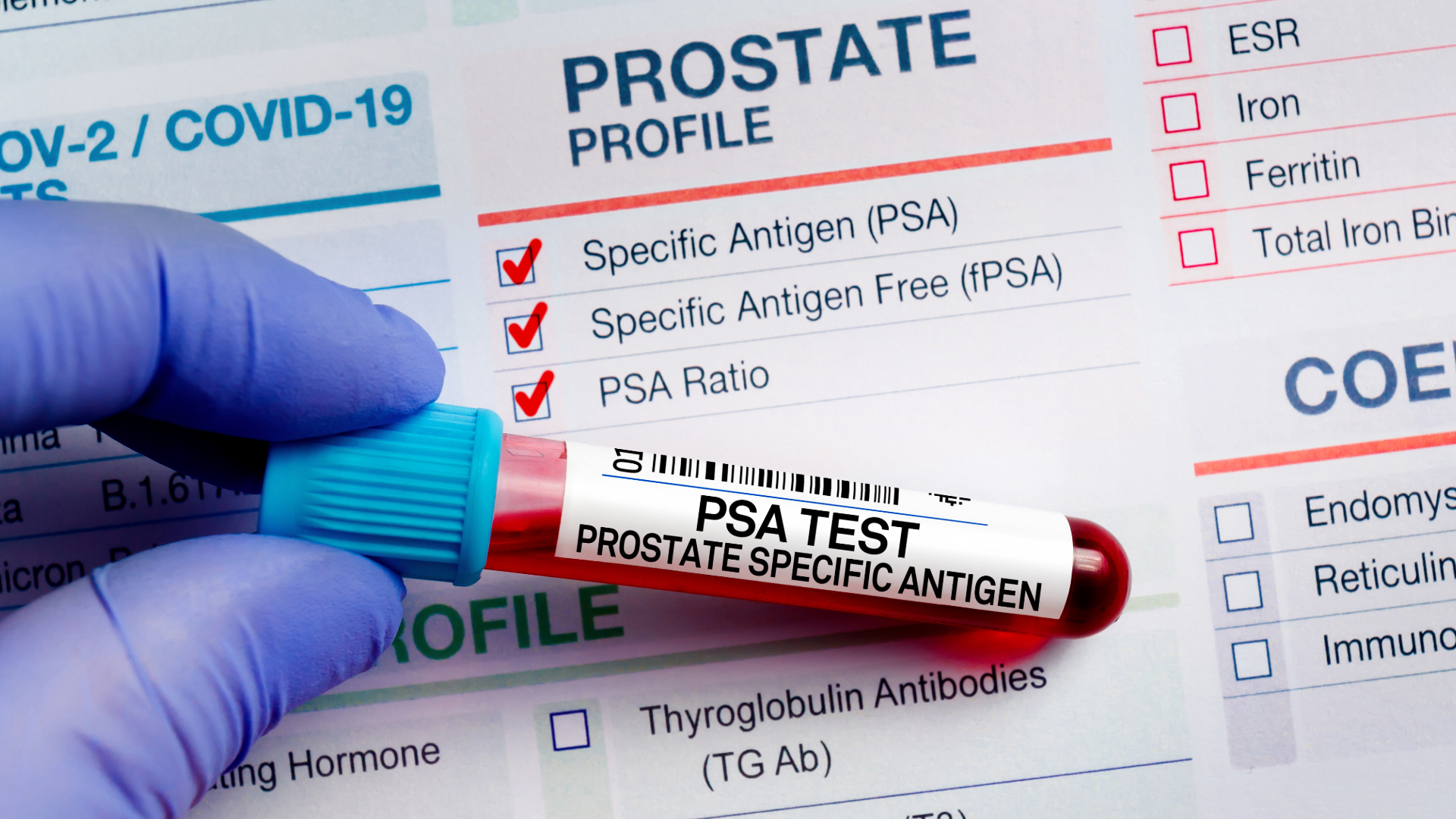 PSA Testi Fiyatı 2026 | İstanbul’da PSA Testi Randevu