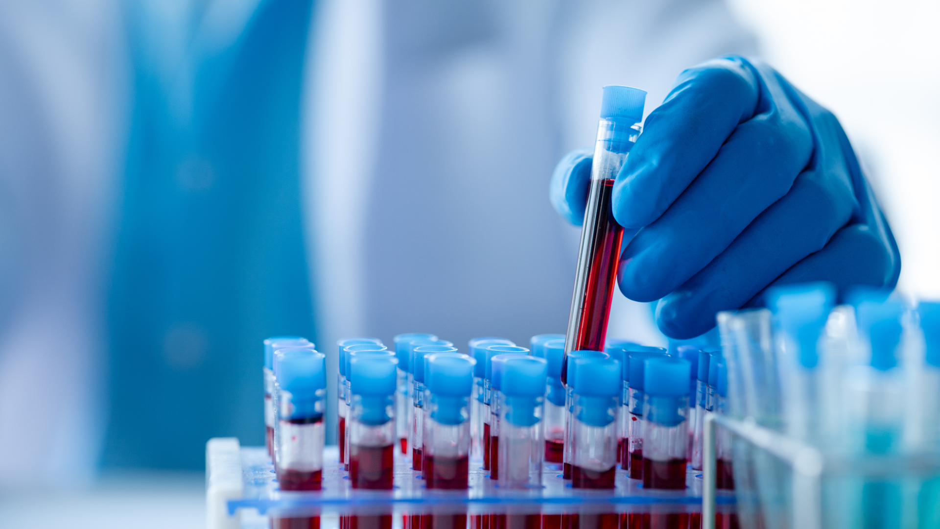Safra Asitleri Testi Fiyatı | Ne Zaman İstenir, Sonuçlar, Normal Değerler